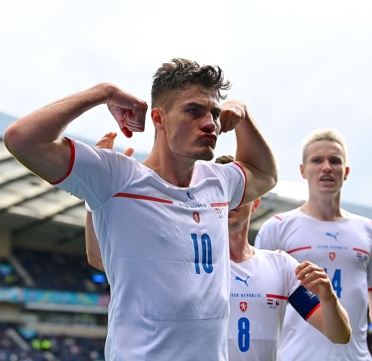 Patrick Schick Wins EURO 2020 Goal Of The Tournament Award (VIDEO ...